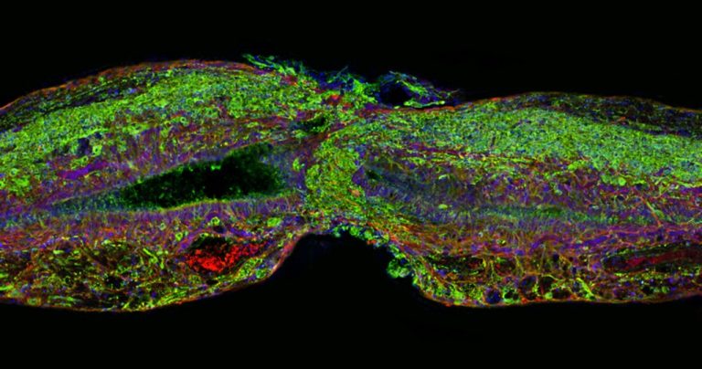 Regenerative Medicine: Restoring What's Lost, Renewing Life